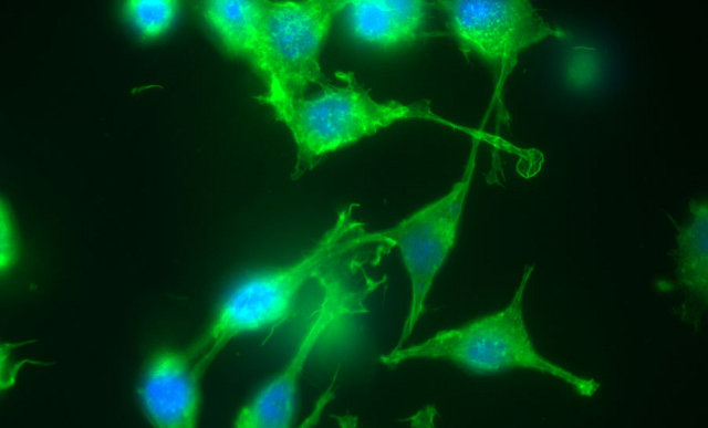 Solid Lipid Nanoparticles: Medical Applications